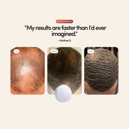 Oral Finasteride for Hair Regrowth | Hims
